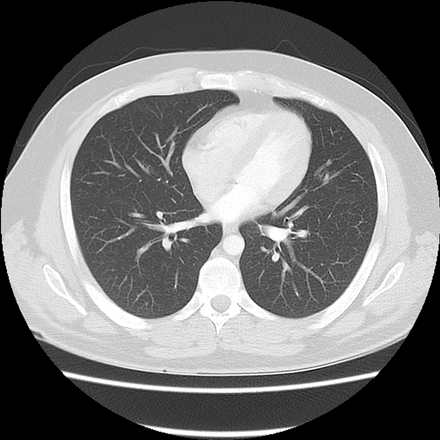 過換気症候群（Hyperventilation syndrome） – 呼吸器疾患 - 神戸きしだクリニック（神戸市中央区）