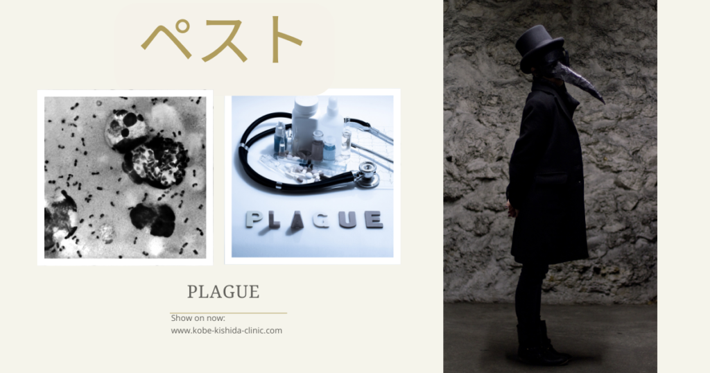 ペスト（Plague） – 感染症 - 神戸きしだクリニック（神戸市中央区）
