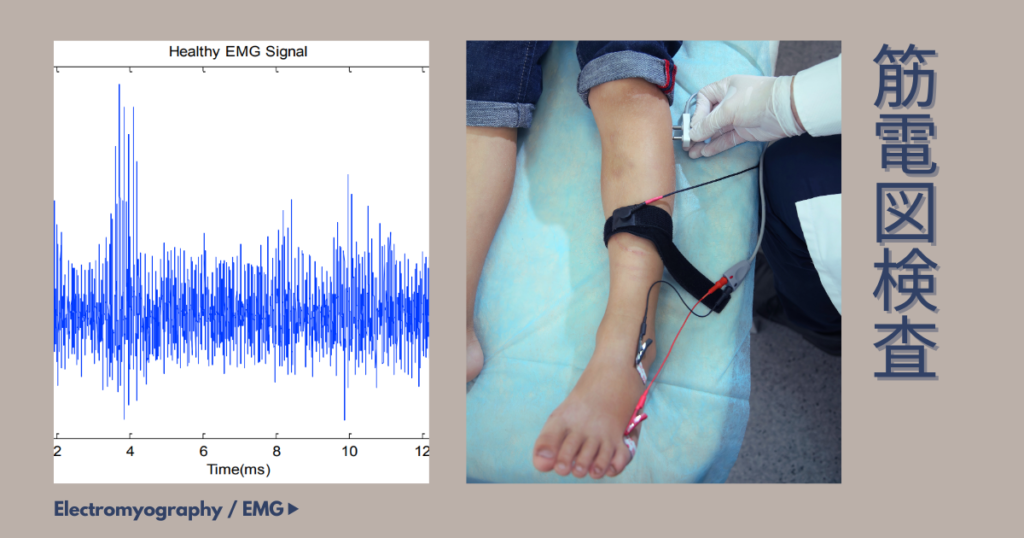 筋電図検査（筋電図 / Electromyography / EMG） - 神戸きしだクリニック（神戸市中央区）