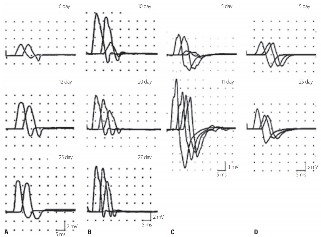 筋電図検査（筋電図 / Electromyography / EMG） - 神戸きしだクリニック（神戸市中央区）