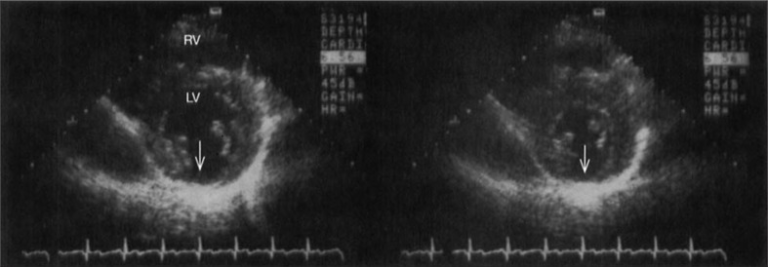 心臓超音波検査（心エコー / Echocardiography / UCG） - 神戸きしだクリニック（神戸市中央区）