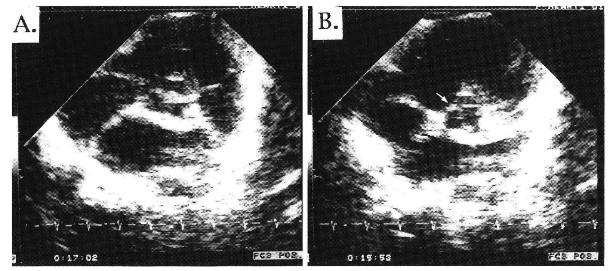 心臓超音波検査（心エコー / Echocardiography / UCG） - 神戸きしだクリニック（神戸市中央区）