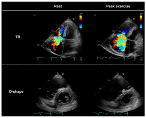 心臓超音波検査（心エコー / Echocardiography / UCG） - 神戸きしだクリニック（神戸市中央区）